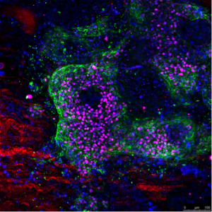 Crean los primeros injertos de corazón humano a partir de células madre ...